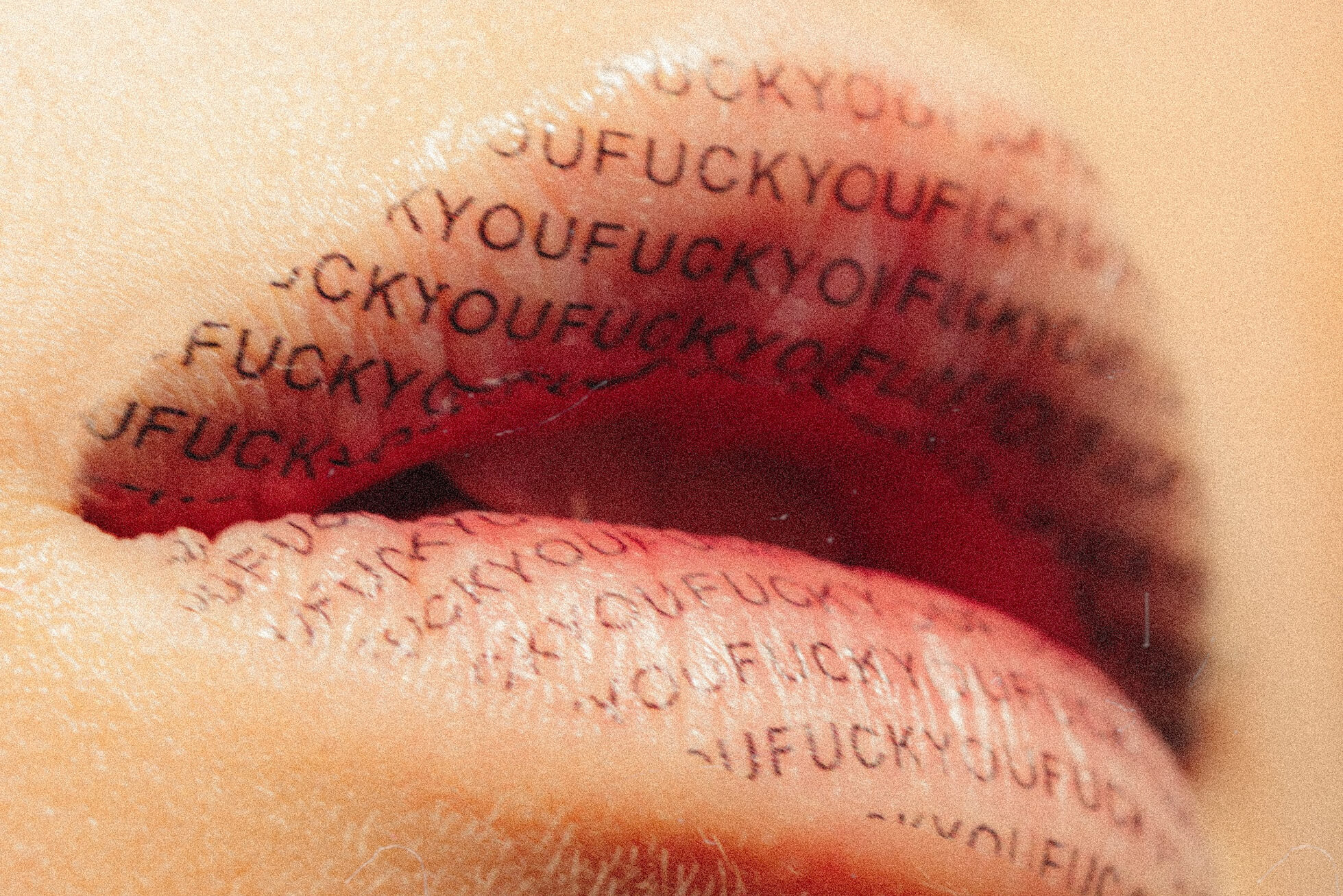 Let's talk straight about Dermal Fillers - Dr. Kelly®